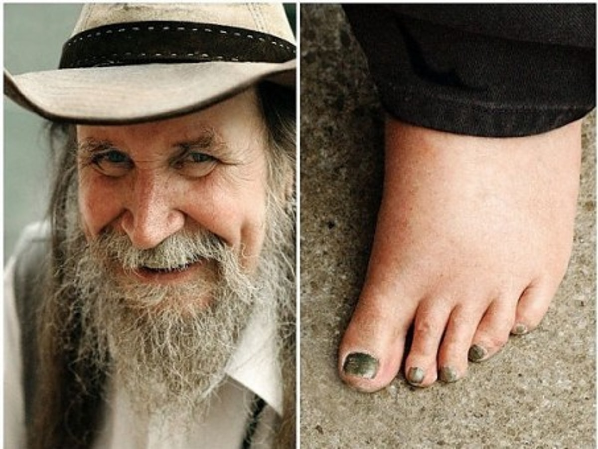 9 Maddede 50 Yıldır Ayakkabı Giymeyen Adam: "Pete the Feet" - Onedio