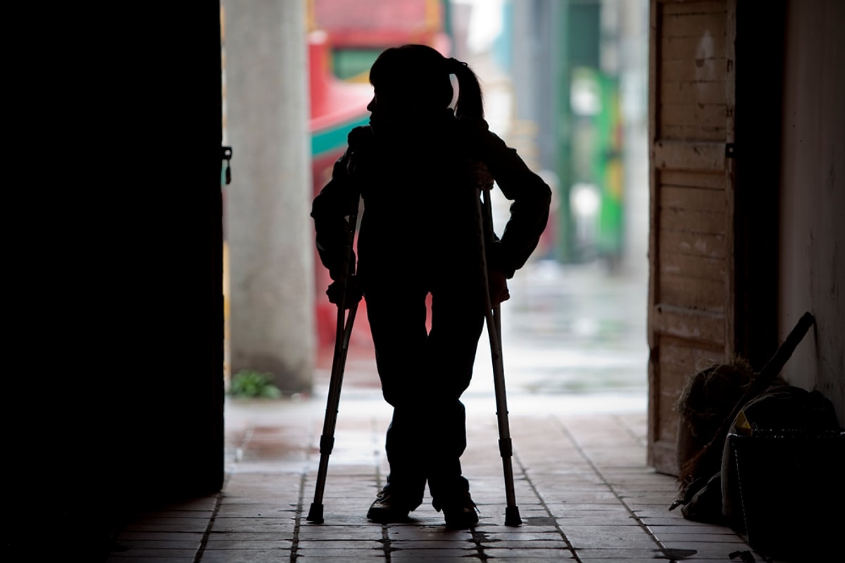 Engelli Bir İnsan Olarak Yaşamanın Ne Kadar Zor Olduğunu Anlatan Bu ...