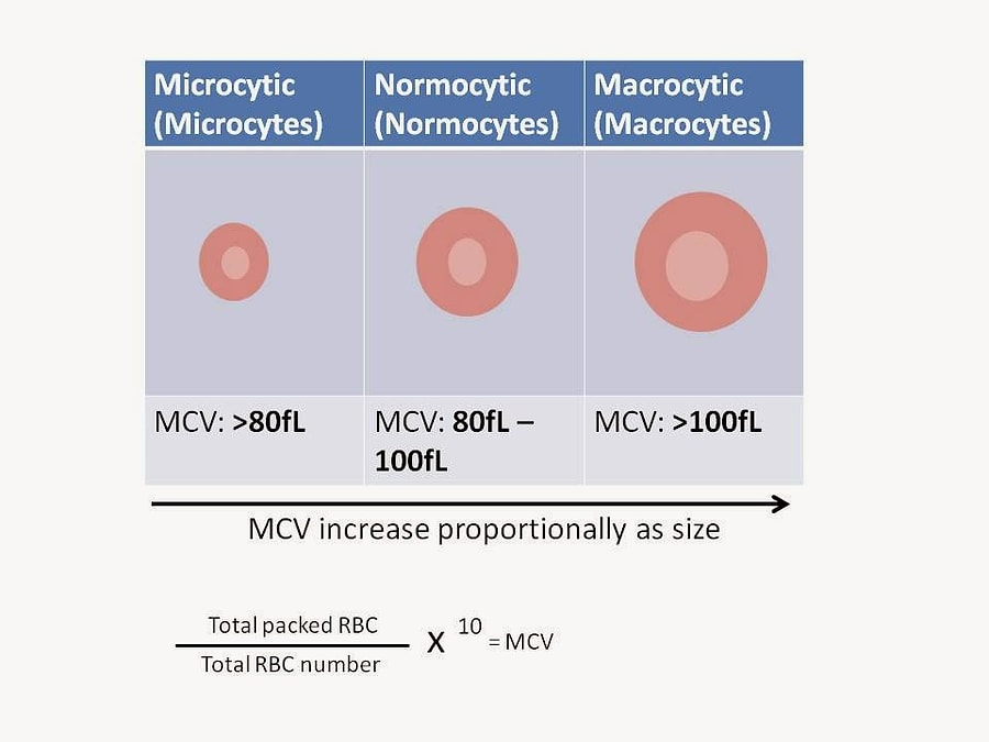 Kan Değerlerinizi Ölçen MCV Nedir? MCV Hakkında Bilmeniz Gereken 5 Şey ...