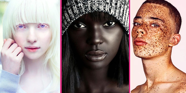 Benzersiz Ten Renkleri ile Meşhur Olmuş Sıra Dışı Bir Görünüme ve ...