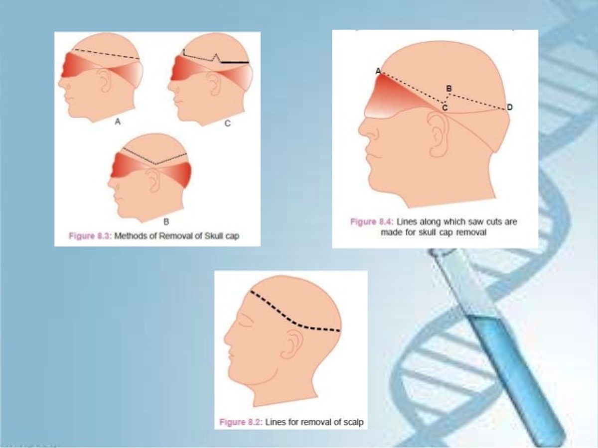 Midesi Hassas Olanlar Uzak Dursun: Bir Otopsi Yardımcısının Gözünden ...
