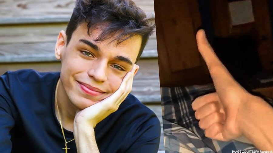 Başparmağı Adeta Alıp Başını Giden, Bağımsızlığını İlan Eden Çocuk ...