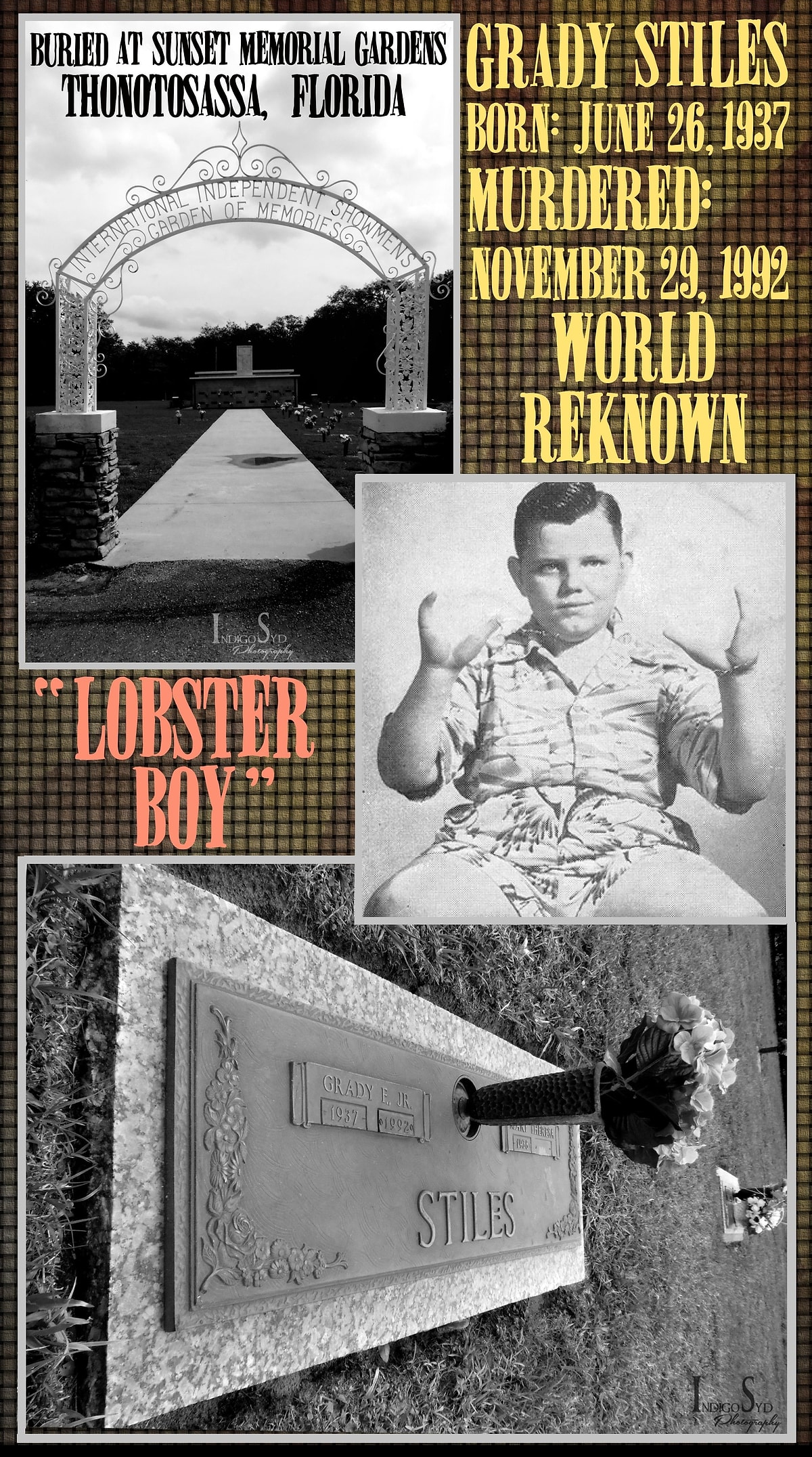 El Yerine Kıskaçlara Sahip Olan "Istakoz Çocuk" Grady Stiles ve Trajik ...