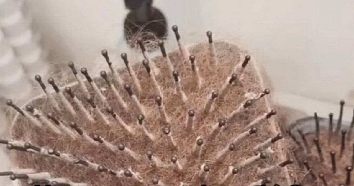 İki Haftada Bir Yıkanmasını Söylediği Taraklardan Çıkardığı Kirle Gören ...