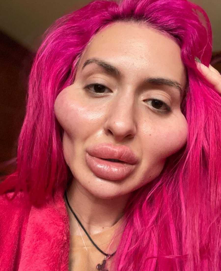 Dünyanın En Büyük Elmacık Kemikli Yanaklarına Sahip Olan Ukraynalı ...