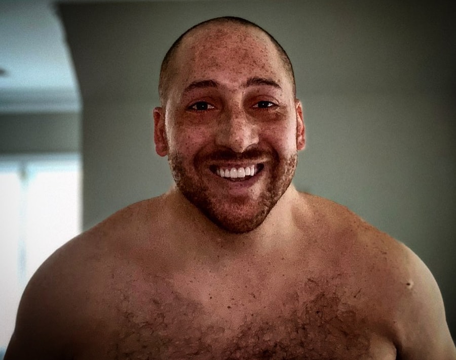 İntihar Köprüsü Olan Golden Gate'den Atladıktan Sonra Mucizevi Şekilde ...