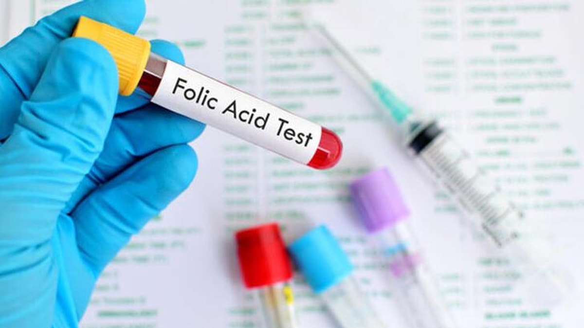 Folik Asit (Folat) Nedir? Yüksekliği ve Düşüklüğü Ne Anlama Gelmektedir ...
