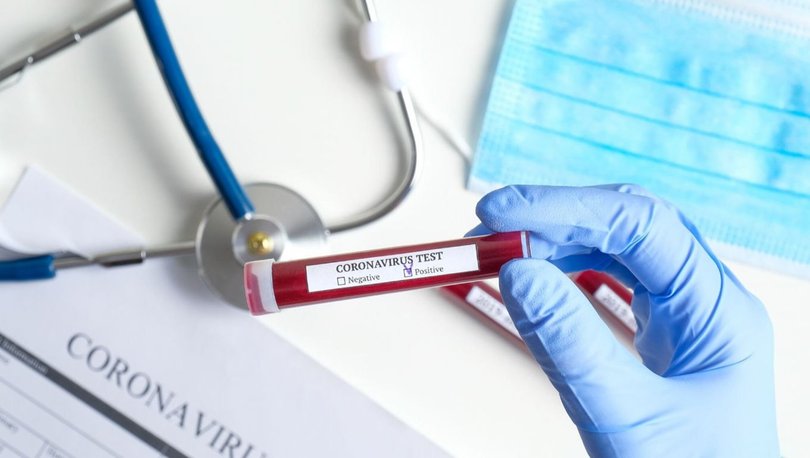 PCR Testi Nerelerde Zorunlu Olacak? PCR Testi Nasıl Yapılır, Sonuçlar ...