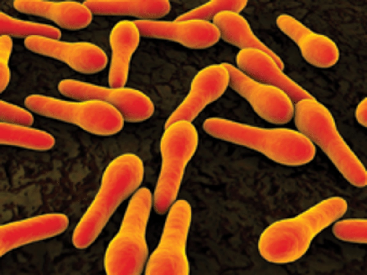 Tetanoz Belirtileri Nelerdir? Tetanoz Nasıl Tedavi Edilir? - Onedio