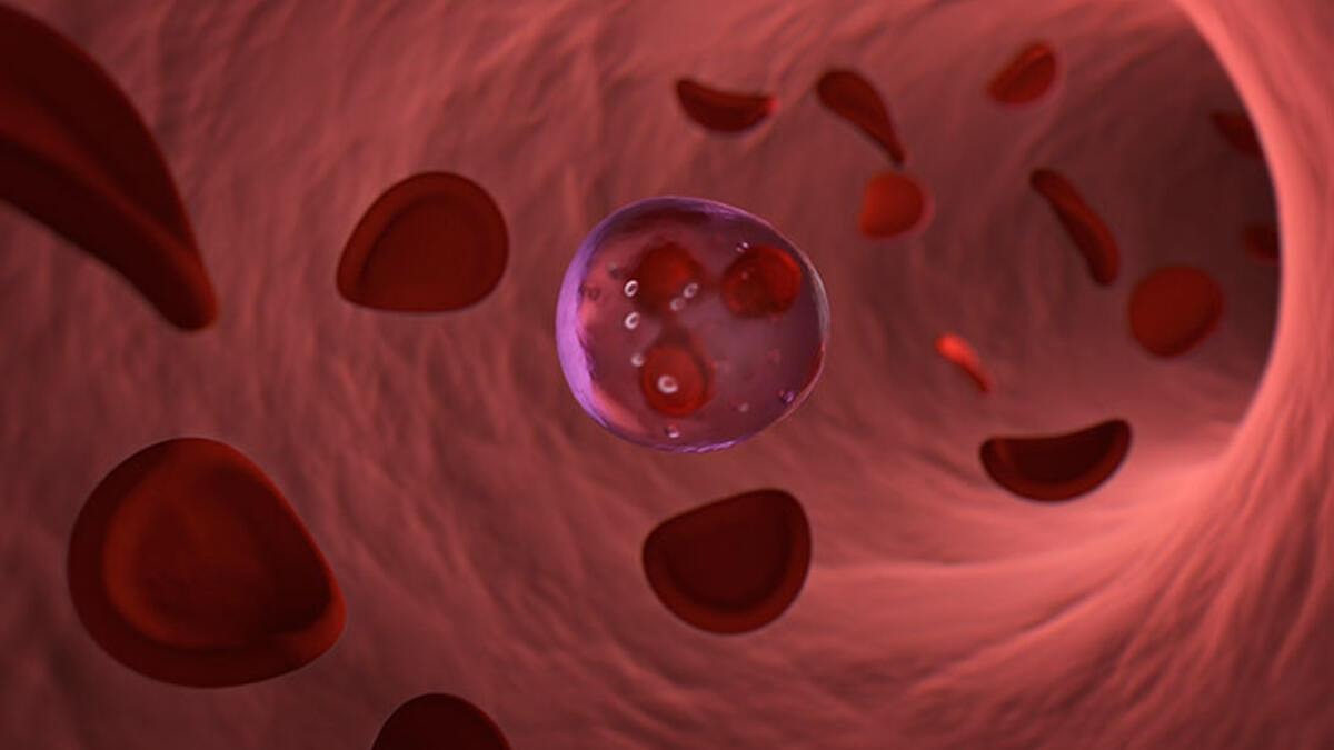 BA%: Bazofil Yüzdesi Nedir? Yüksekliği ve Düşüklüğü Ne Anlama ...