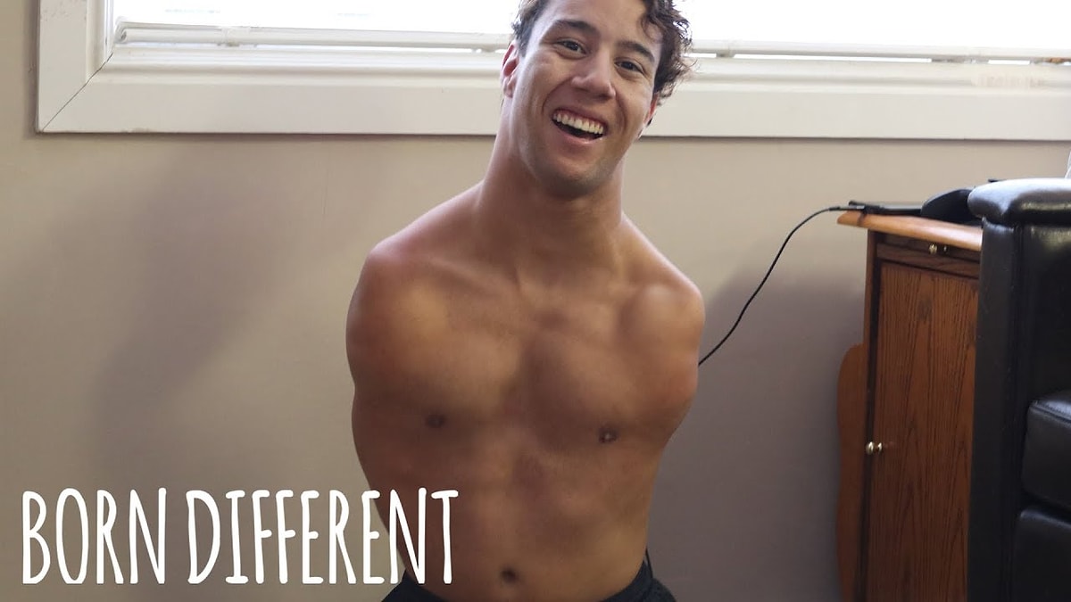 Kol ve Bacakları Olmadan Doğan Gabe Adams'ın İlham Veren Hayat Hikayesi ...