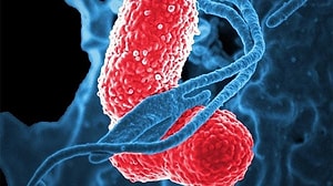 MO%: Monosit Yüzdesi Nedir? Yüksekliği ve Düşüklüğü Ne Anlama Gelir ...