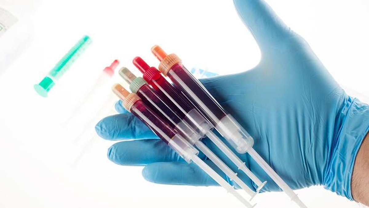 Anti Tiroglobulin Antikor Nedir? Yüksekliği ve Düşüklüğü Ne Anlamlara ...