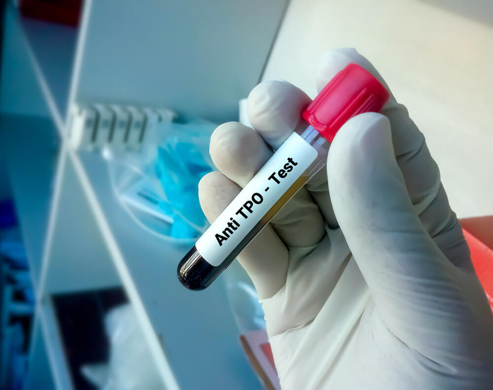 Anti TPO Nedir? Yüksekliği ve Düşüklüğü Ne Anlama Gelir? Değerleri Kaç ...