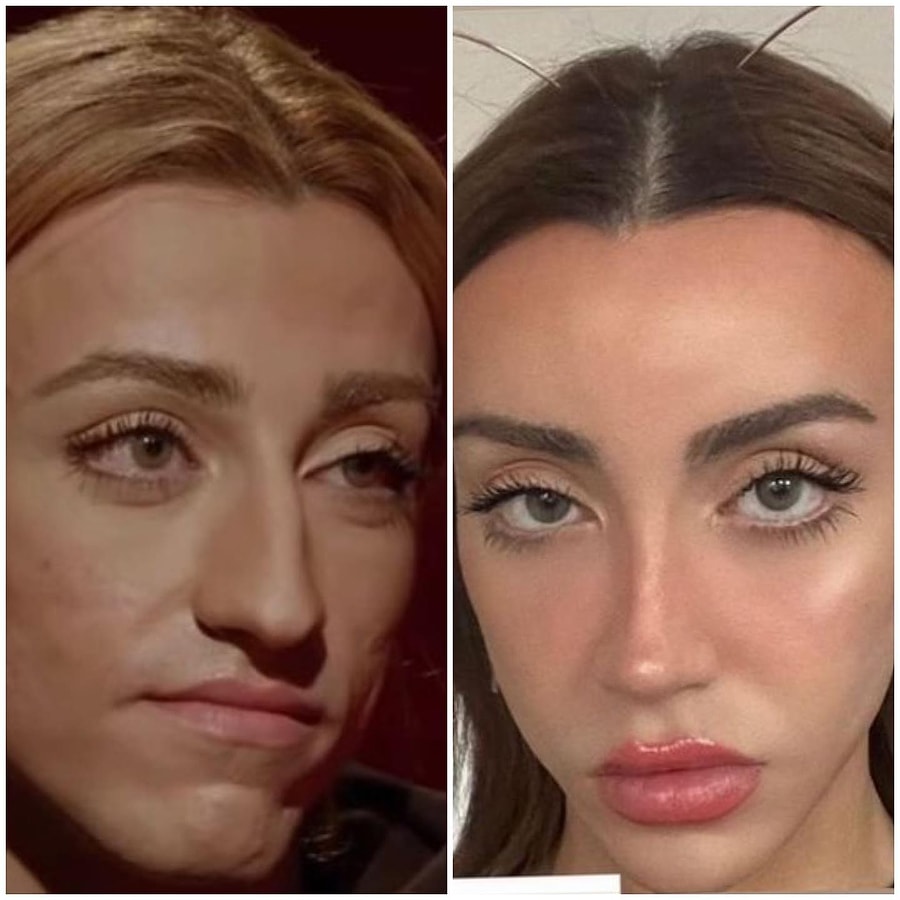 Fenomen Mika Raun'un Estetikle Büyük Değişimi - Onedio