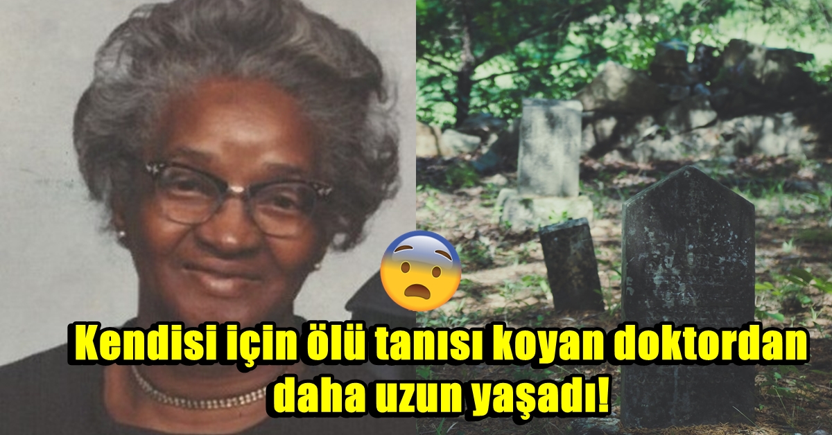 Essie Dunbar'ın Hikayesi - Onedio