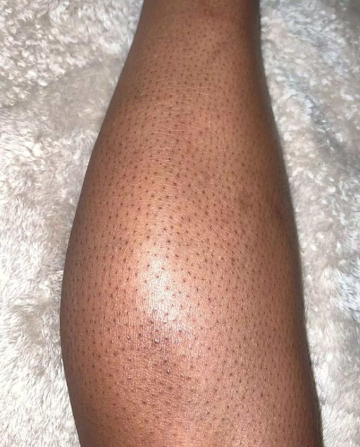 Bacak ve Ayak Sağlığınız İçin Önemli 10 Kural - Onedio