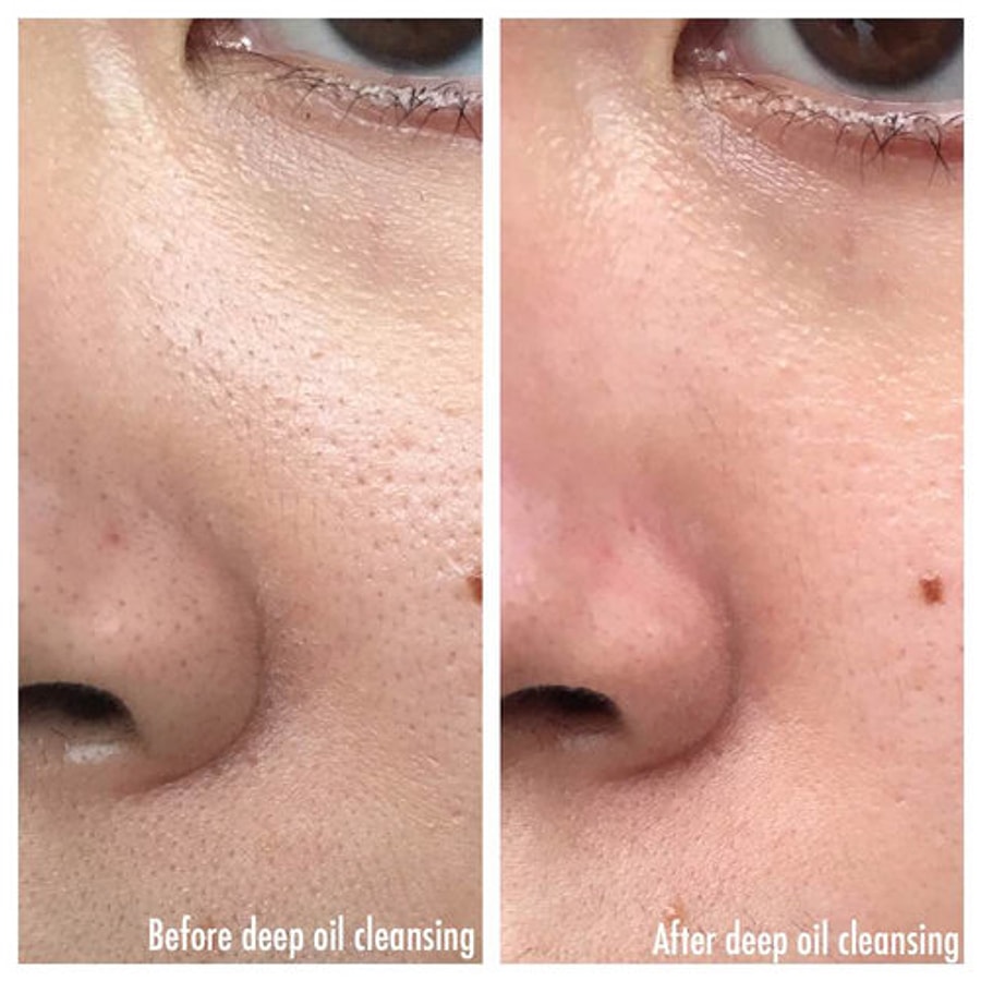 Fiddy Methodu Nasıl Uygulanır? - Onedio