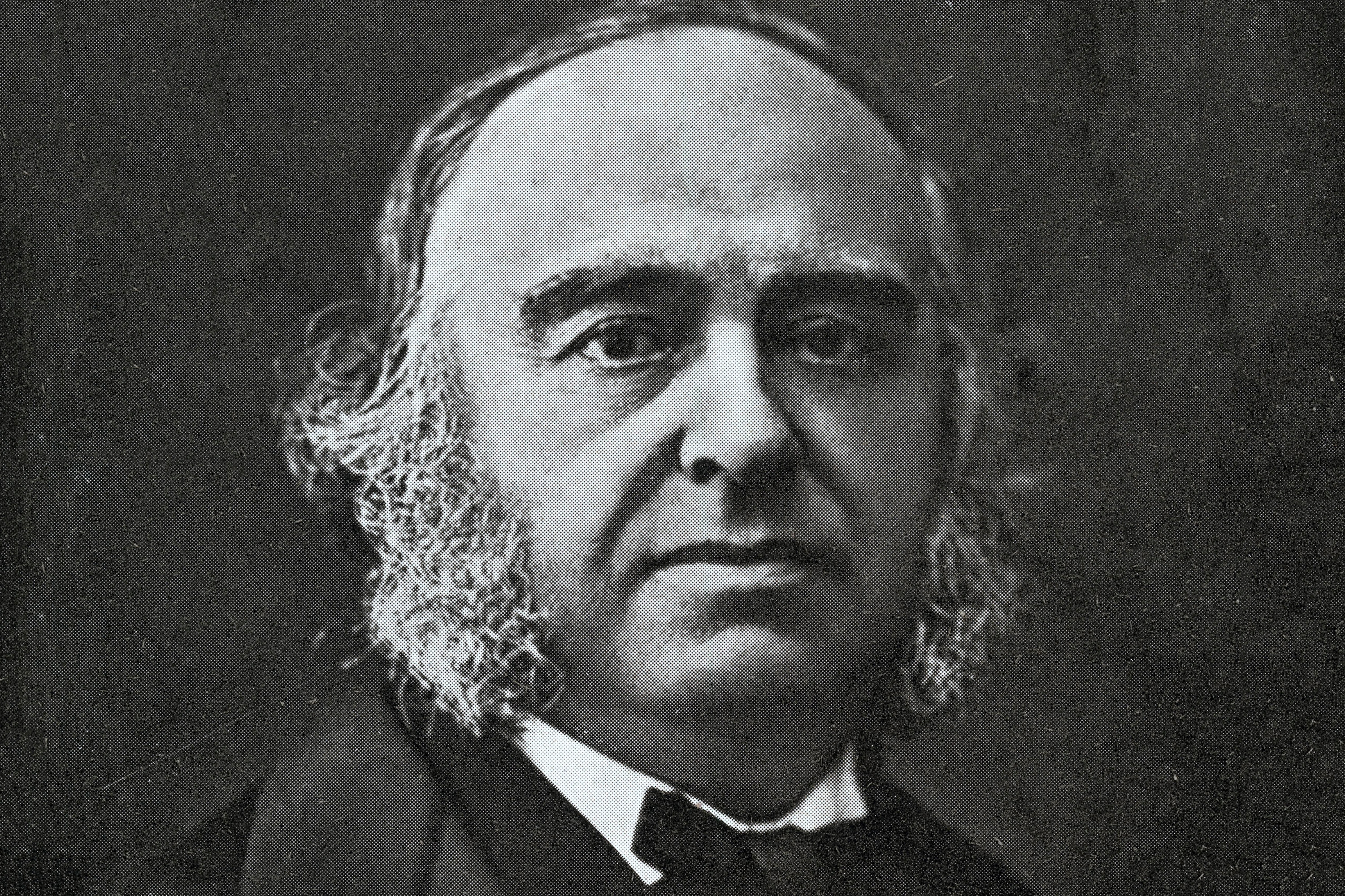 Paul Broca kimdir? - Onedio