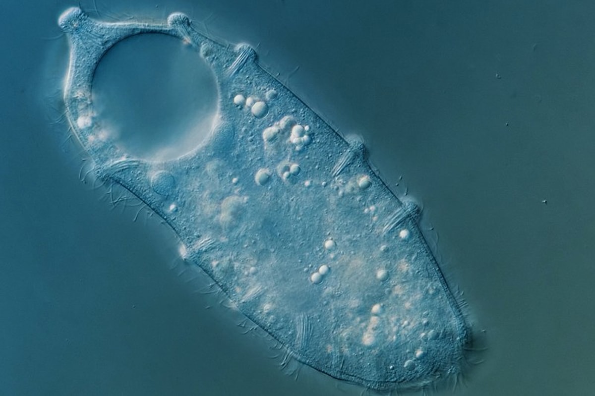 Discovery Of Rare Microbe Species Expands Tree Of Life - Onedio