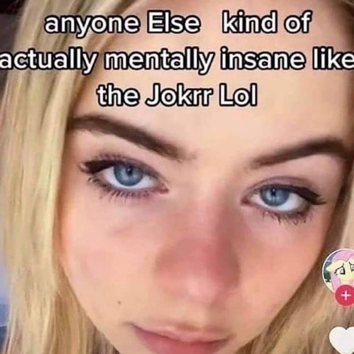 Görünce Tansiyonunuzu Zıplatacak 15 Cringe Görsel - Onedio