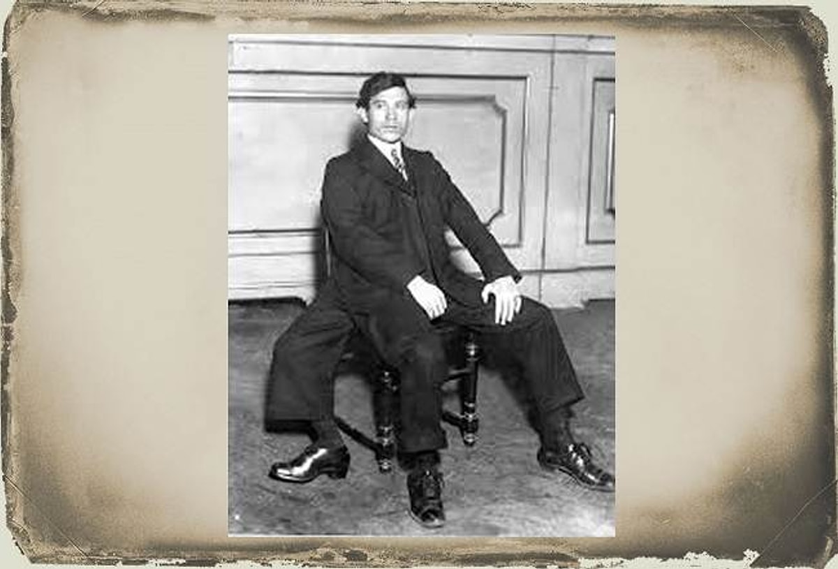 2 Cinsel Organı ve 3 Bacağı Olan Frank Lentini - Onedio