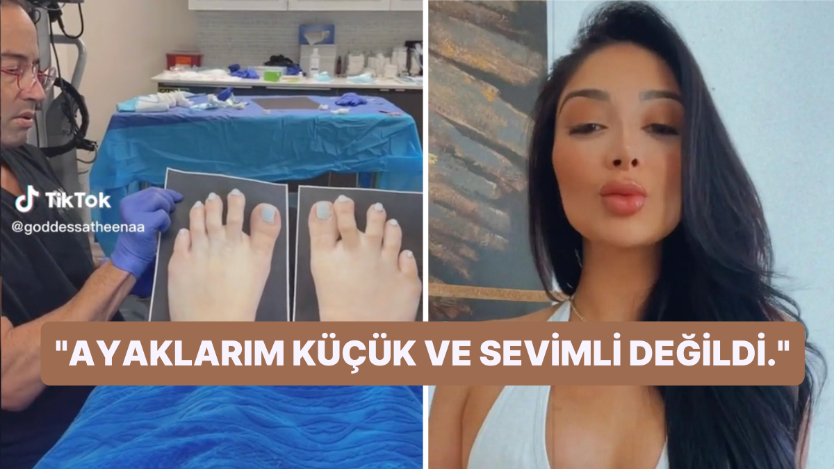 Ayak Parmaklarına Estetik Yaptıran Kadın - Onedio