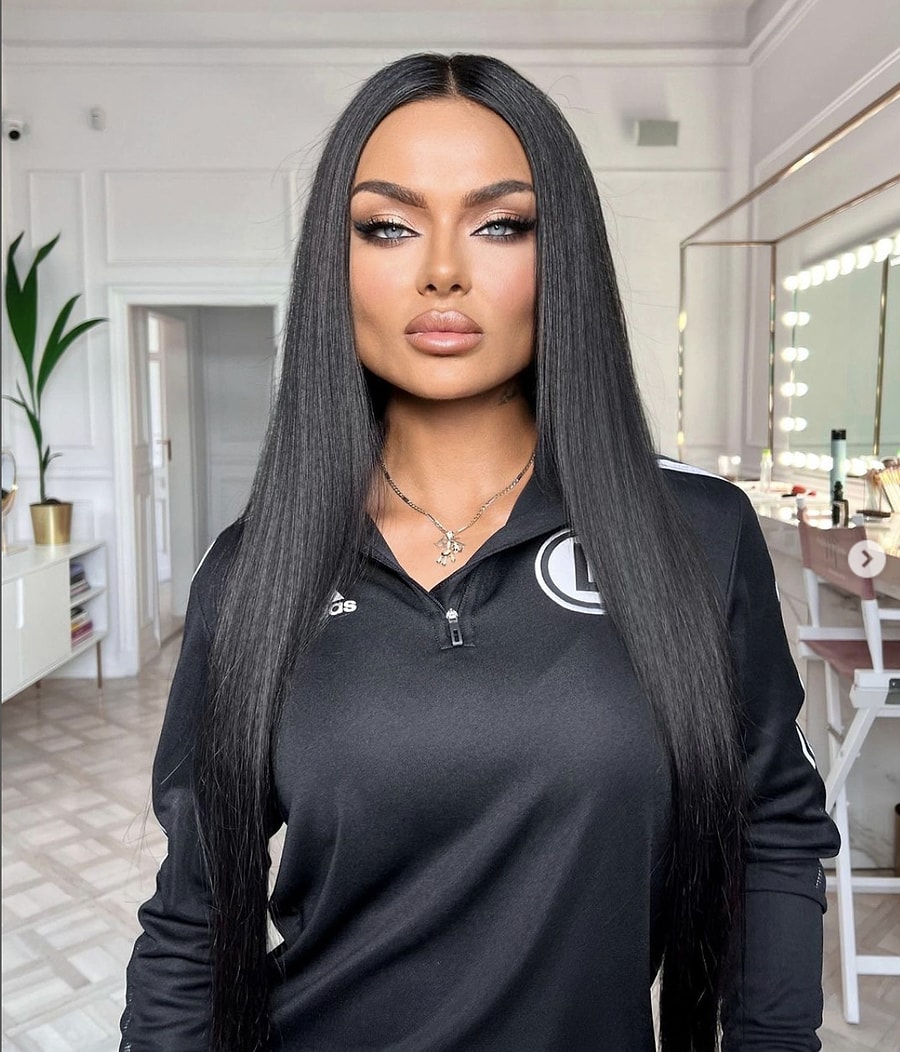 Kamila Smogulecka İyileşme Sürecini Anlattı - Onedio