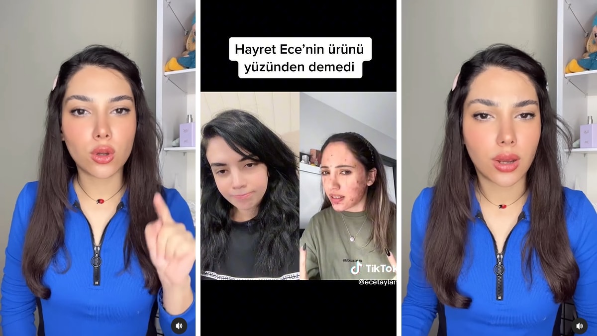 Kullandığı Sivilce Jeli Yüzünden Ağlayarak Acillik Olan Fenomen Tuğba ... Kullandığı Sivilce Jeli Yüzünden Ağlayarak Acillik Olan Fenomen Tuğba ...