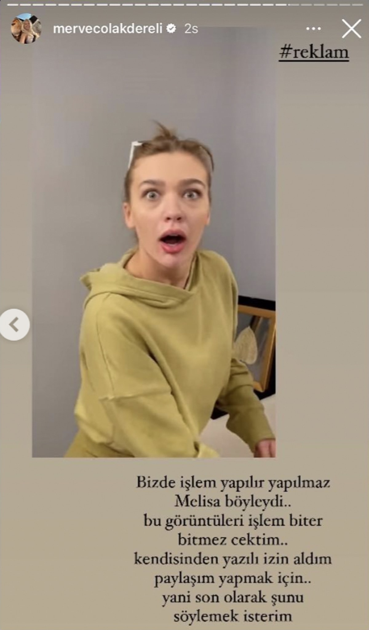 Melisa Döngel'in Şaşırtan Değişimi! - Onedio