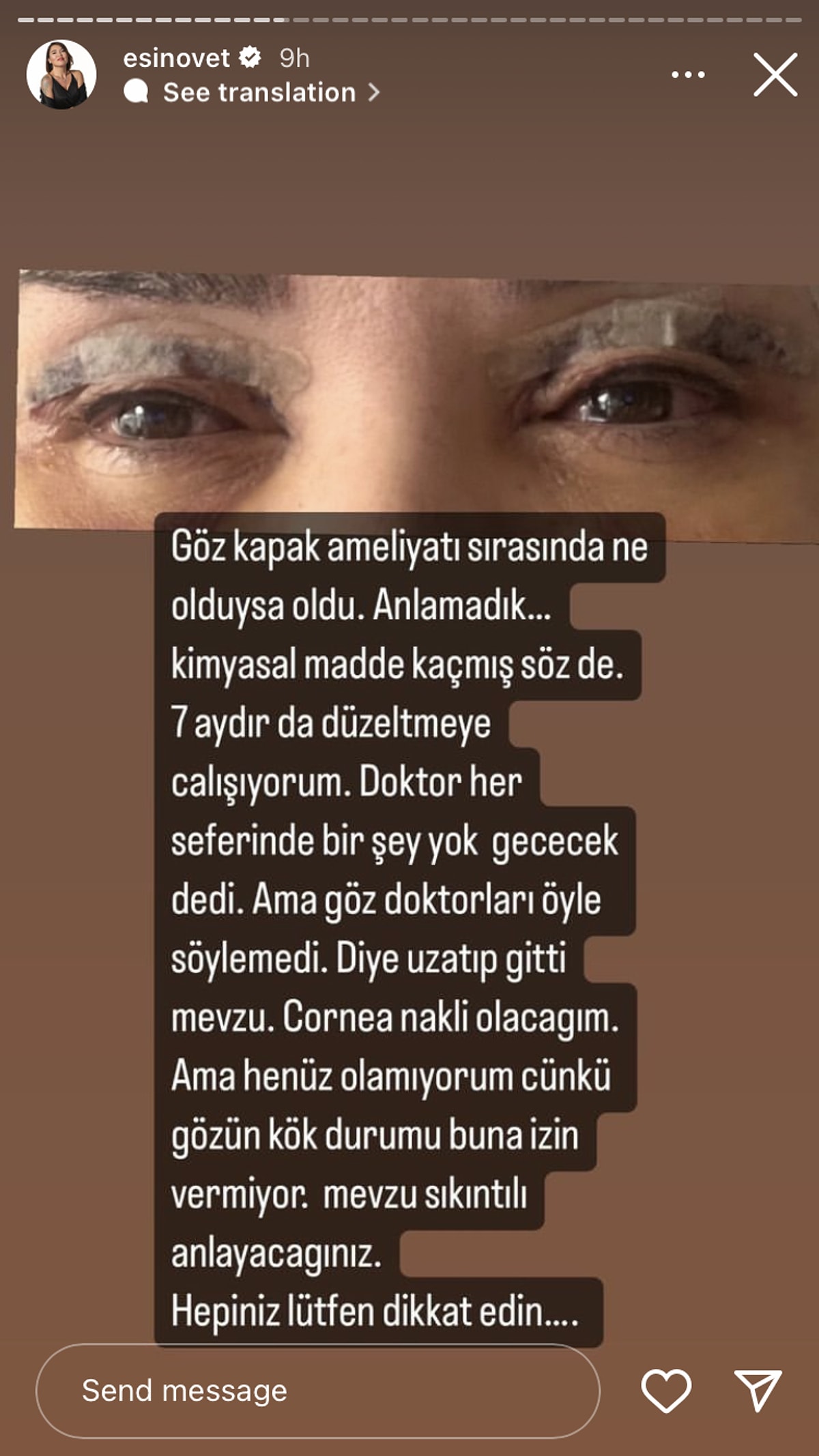 Gazeteci Esin Övet Estetik Kurbanı Oldu - Onedio