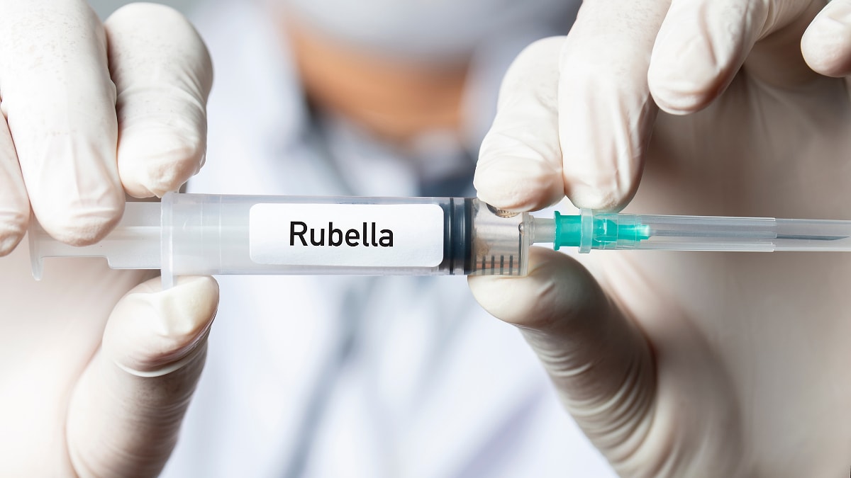 Hamilelikte Anti Rubella IGG değeri kaç olmalı? - Onedio