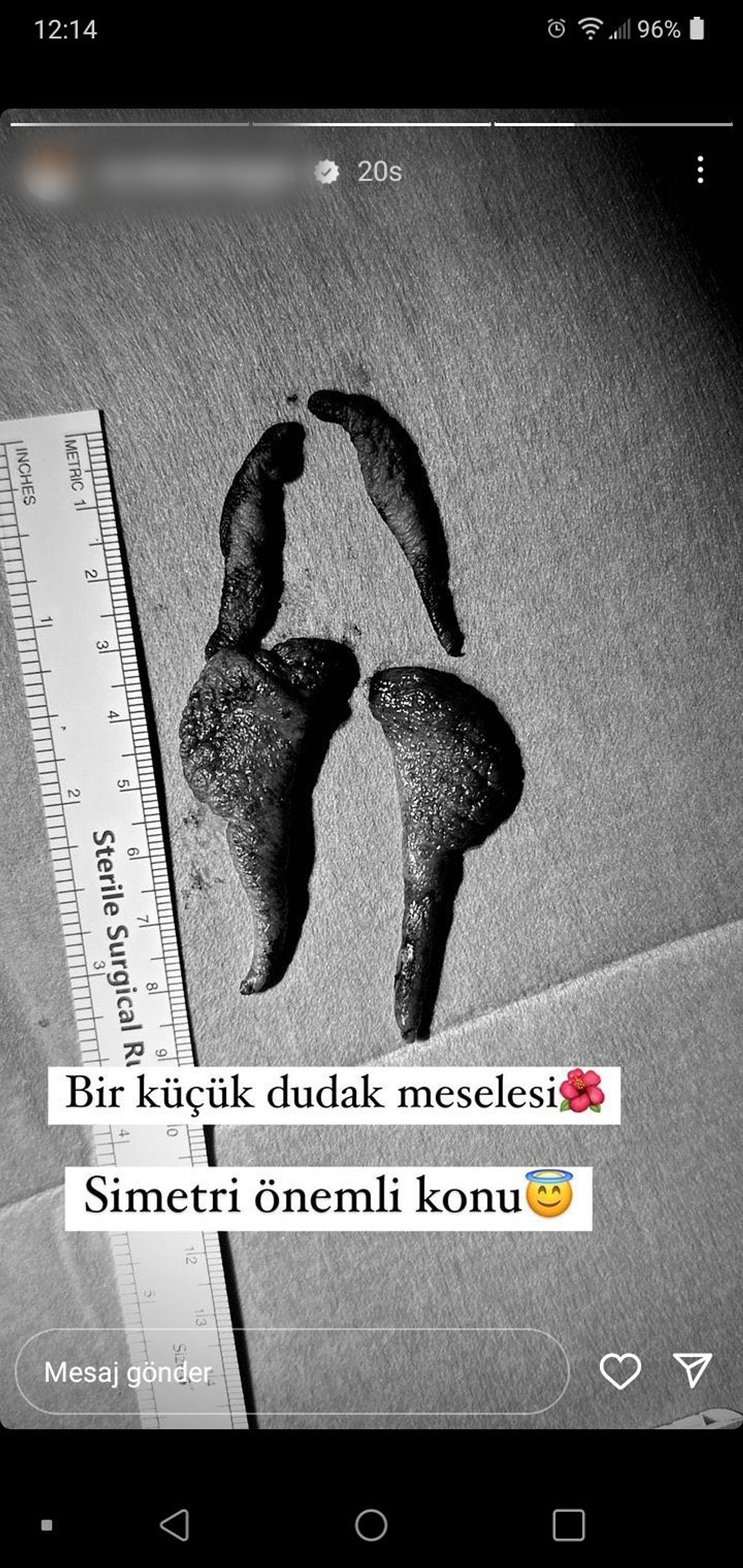 Barbie Vajina Adı Verilen İşlem Tepki Çekti - Onedio