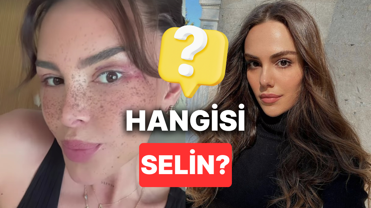 Kızıyla Yeni Bir Hayat Kurarken Badem Göz Ameliyatı Olan Selin Ciğerci ...