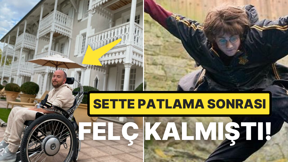 Harry Potter'ın Felç Kalan Dublörünün Hikayesi! - Onedio