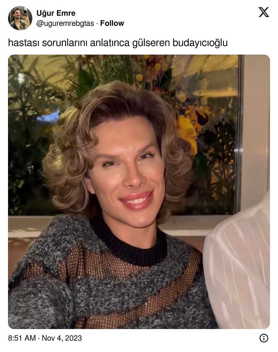 Samet Liçina'nın Saçları - Onedio