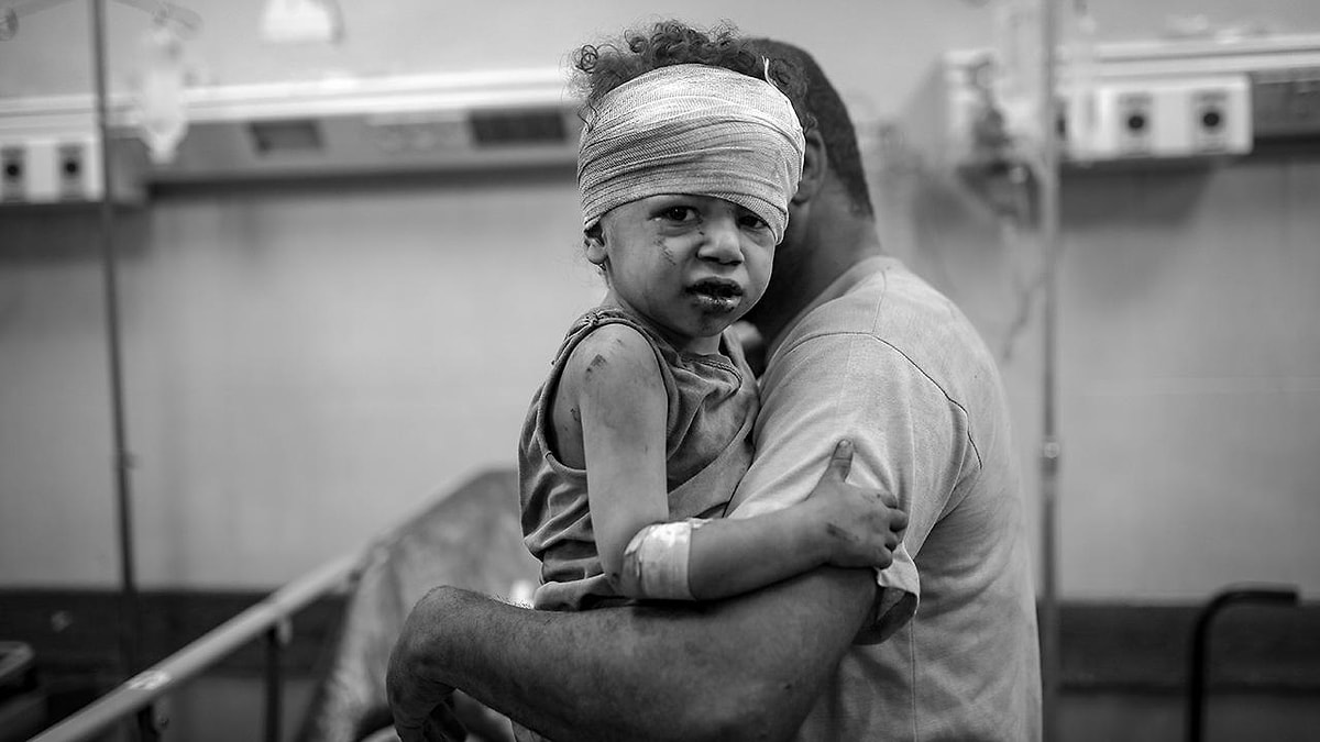 Gazze’deki En Acı Tablolardan Biri: 900 Civarında Çocuk Uzuvlarını ...