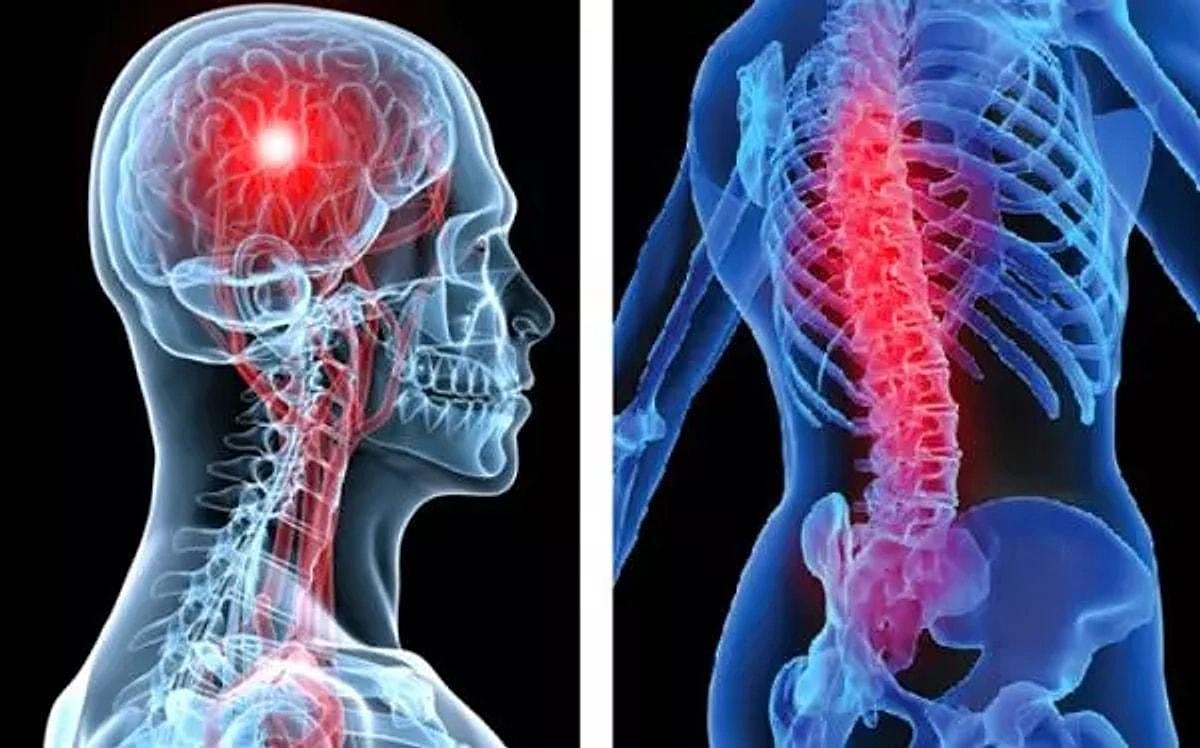 Where Does Stress Accumulate Most in Our Bodies? The Physical ...