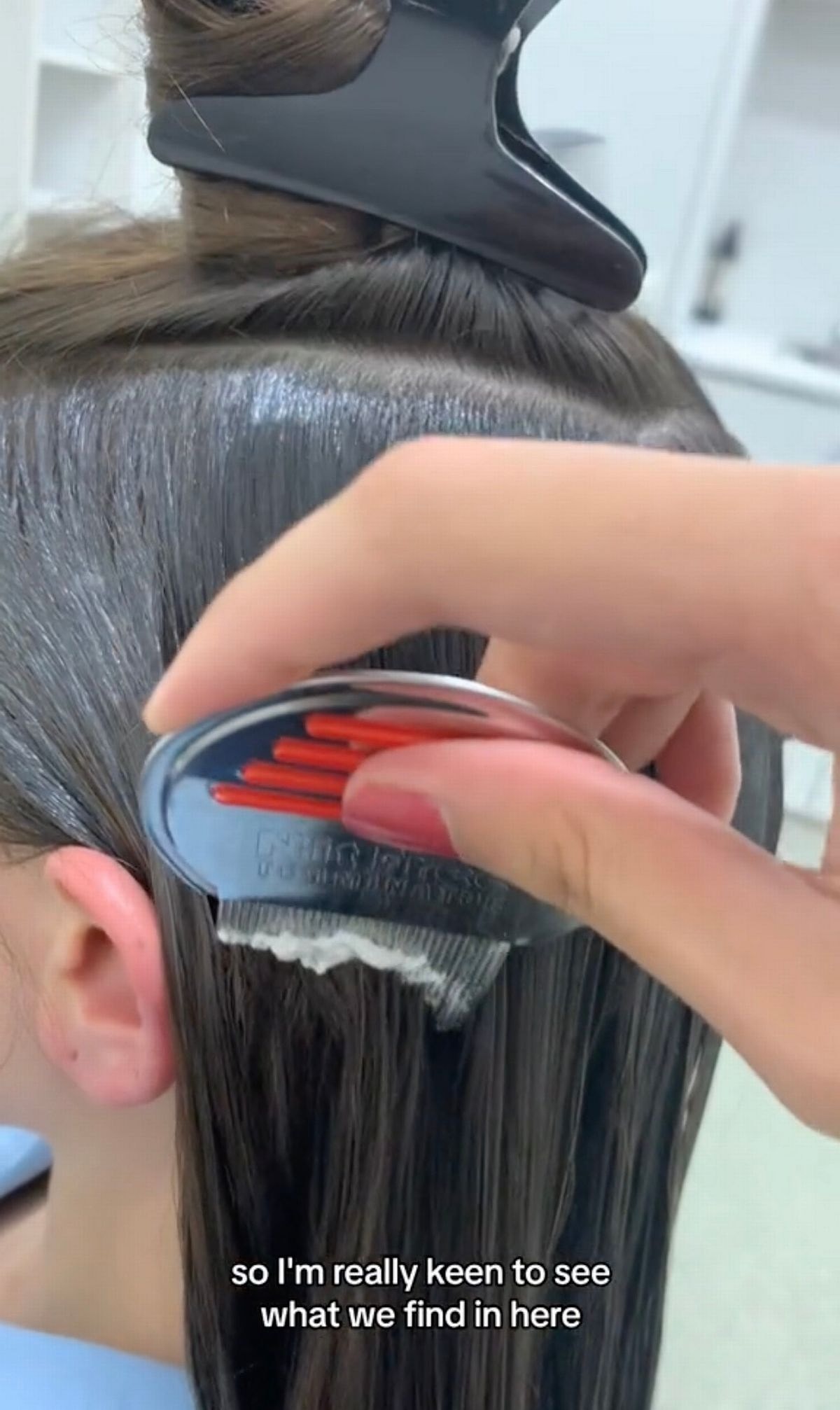 Bitlenen Öğrencinin Saçını Temizleyen TikTok Kullanıcısı, Paylaşımıyla ...