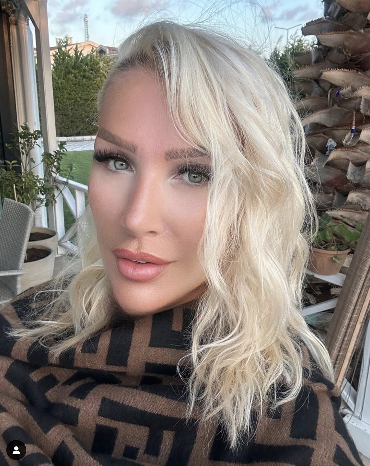 Cildine Sünnet Derisi Enjekte Ettiren Seda Sayan "Yaptıran Çok ...