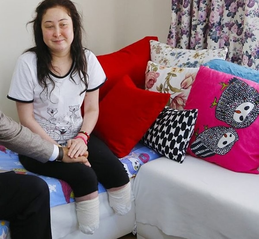 Estetik Faciası! Burun Ameliyatı Sonrası Bacaklarını Kaybetti: 10 Sene ...