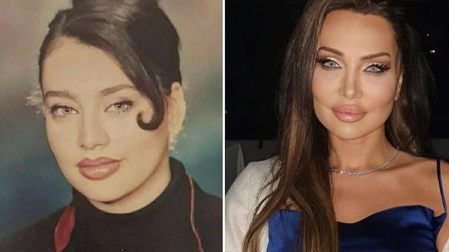 Estetik Yaptırma Konusunda Dur Durak Bilmeyen Yerli Angelina Jolie'miz ...