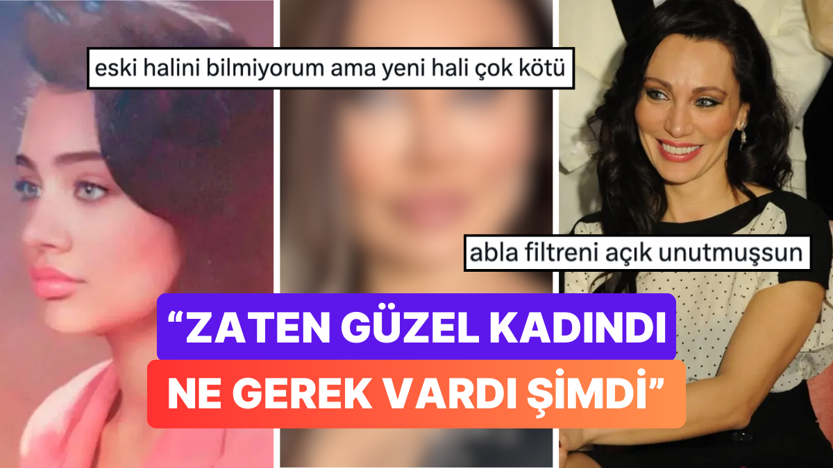 Estetik Yaptırma Konusunda Dur Durak Bilmeyen Yerli Angelina Jolie'miz ...