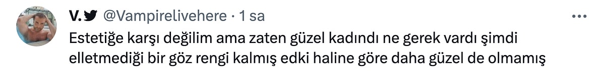 Estetik Yaptırma Konusunda Dur Durak Bilmeyen Yerli Angelina Jolie'miz ...