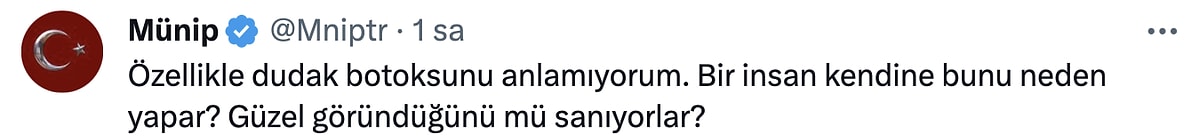 Estetik Yaptırma Konusunda Dur Durak Bilmeyen Yerli Angelina Jolie'miz ...