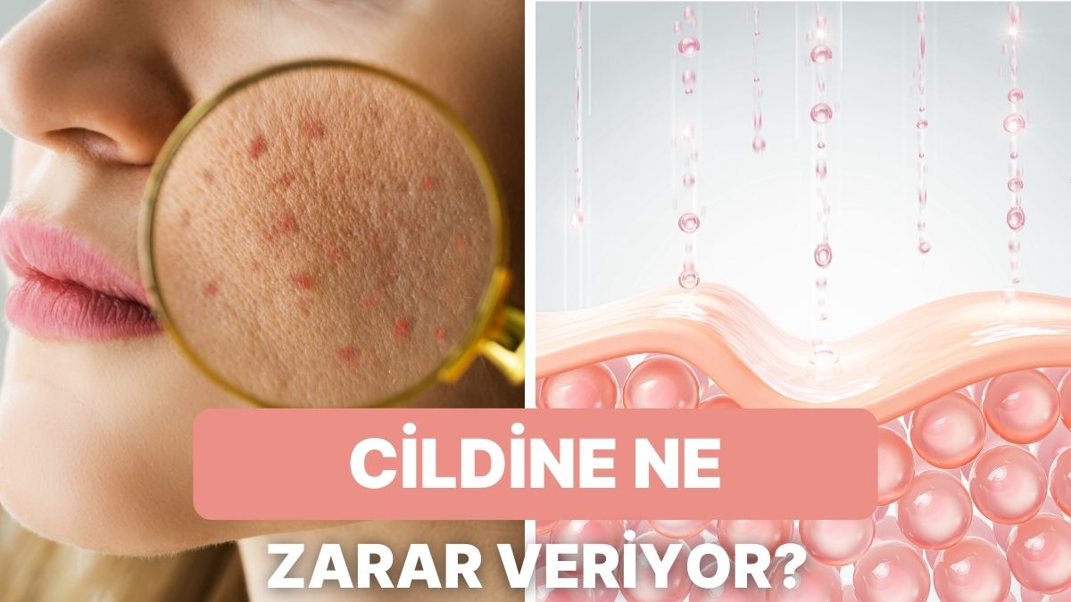 Cildine En Çok Zarar Veren Şey Ne? - Onedio
