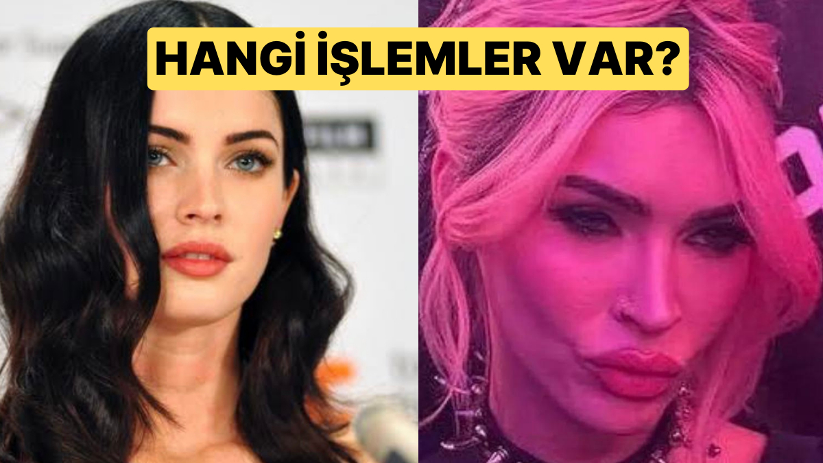 Eski Halini Mumla Aradığımız Megan Fox'un Estetik İşlemlerini Uzman ...