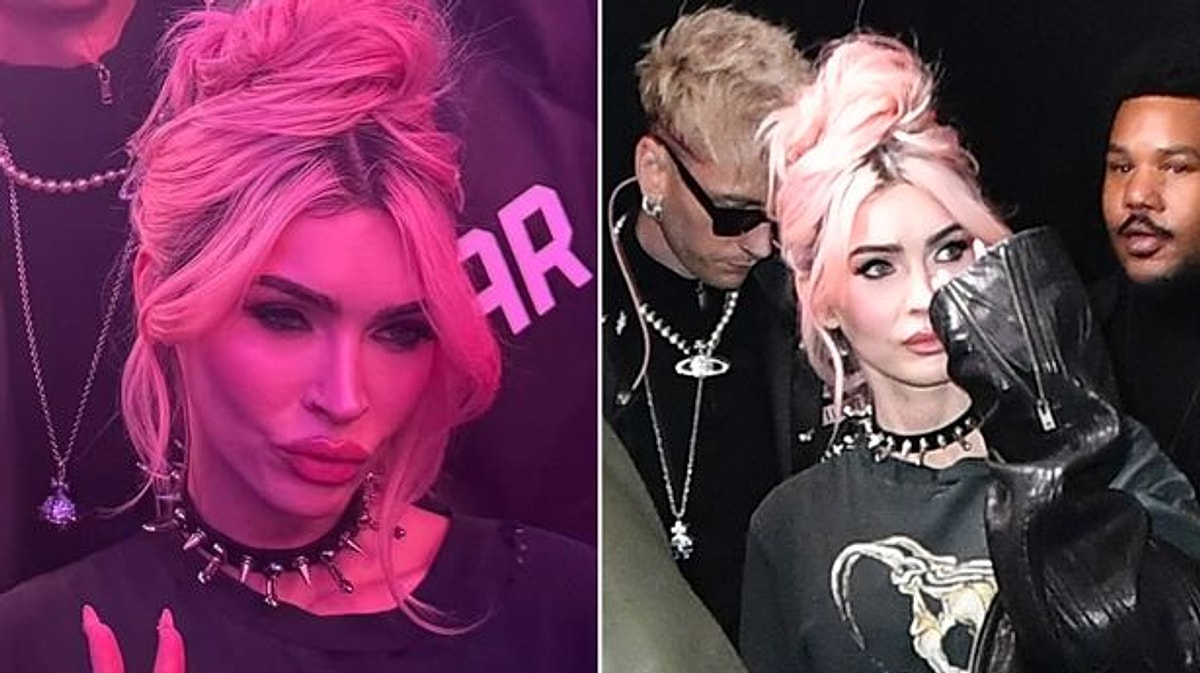 Eski Halini Mumla Aradığımız Megan Fox'un Estetik İşlemlerini Uzman ...