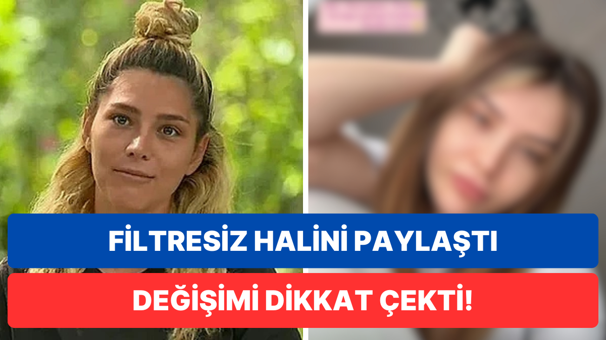 Survivor İlayda Şeker'in Filtresiz Fotoğrafı - Onedio