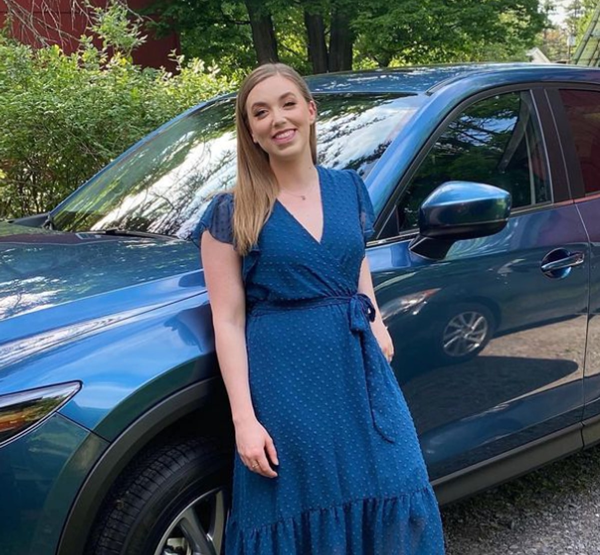 Yüzündeki Doğum Lekesinden Dolayı Zorbalandıktan Sonra 20 Ameliyat ...